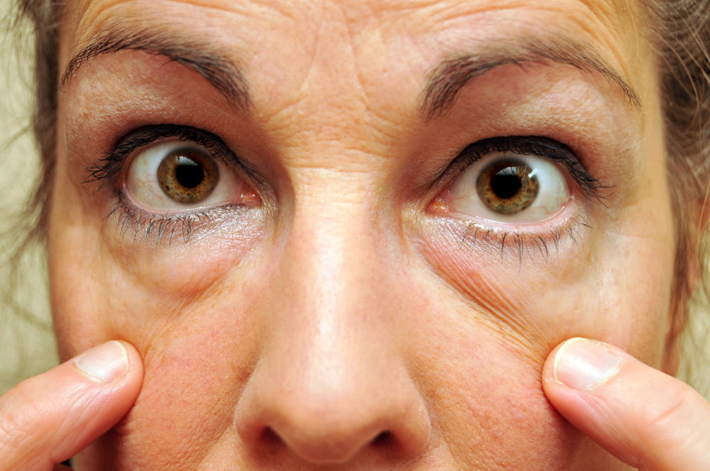Tips To Get Rid Of Bags Under Your Eyes