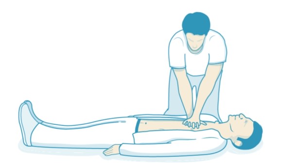 An Animated Guide to Performing CPR | Health - BabaMail